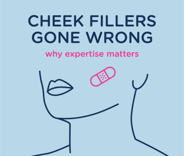 Cheek Fillers Gone Wrong - Why Expertise Matters | Skin Wellness ...