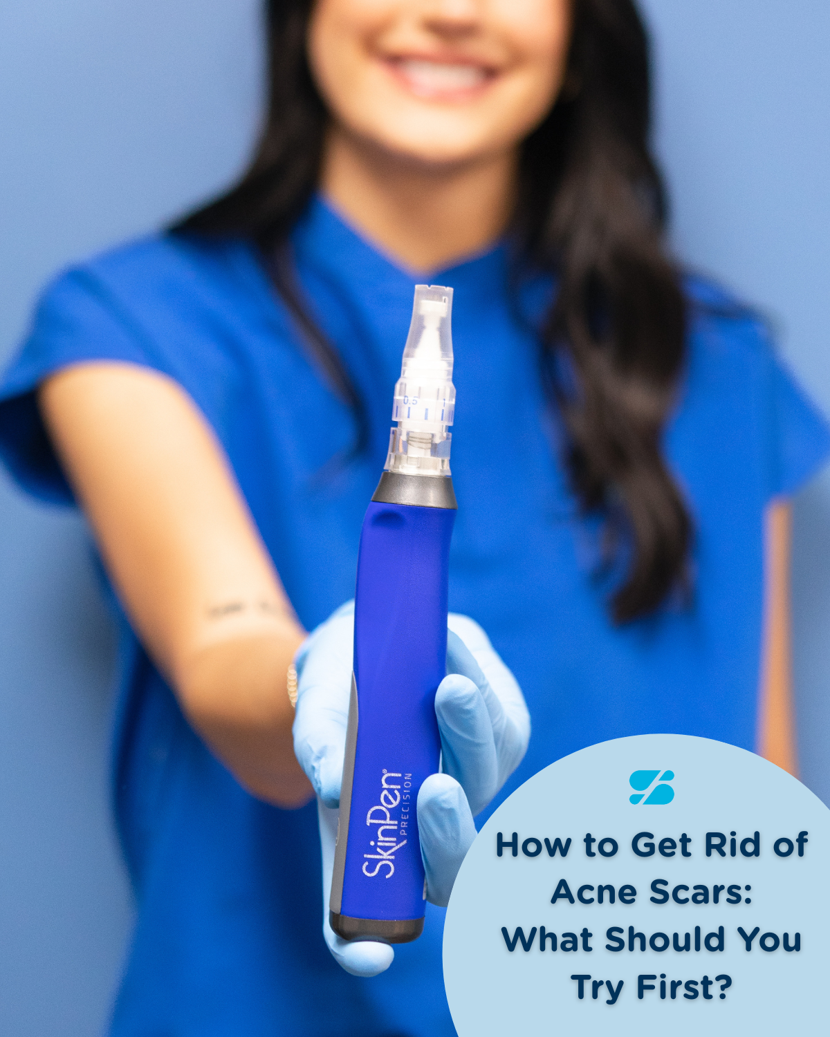 How to Get Rid of Acne Scars: What Should You Try First? | Skin ...